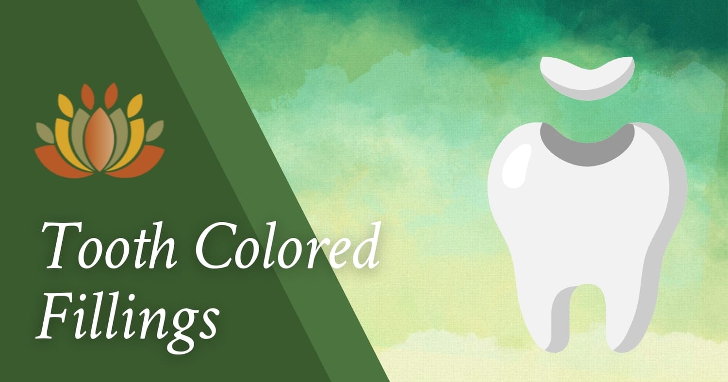 Color Match Fillings — La Jolla, Chula Vista