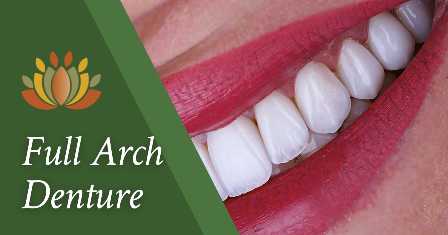Full Arch Denture — La Jolla, Chula Vista