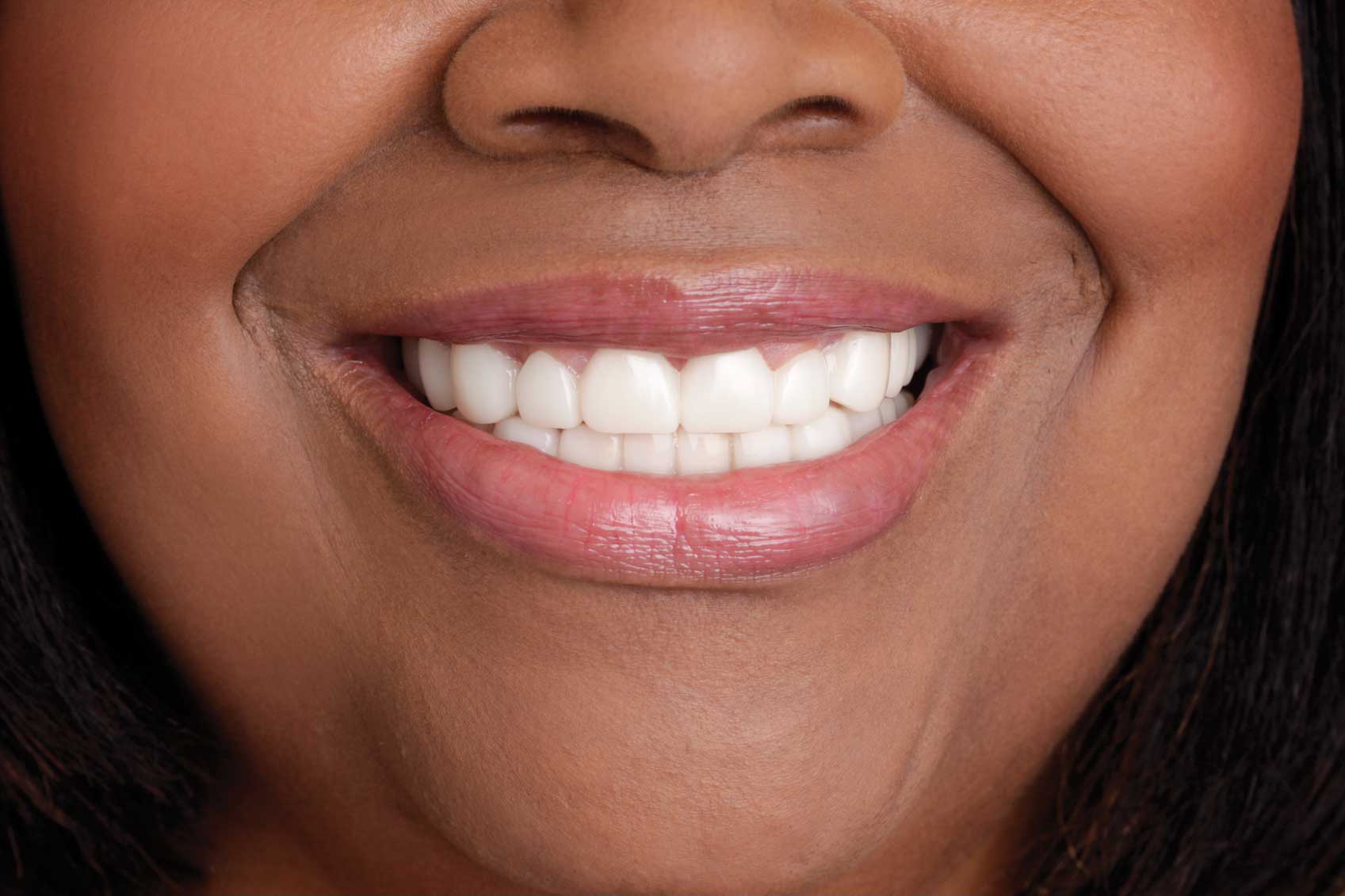 Life Smiles Dental Care | Chula Vista