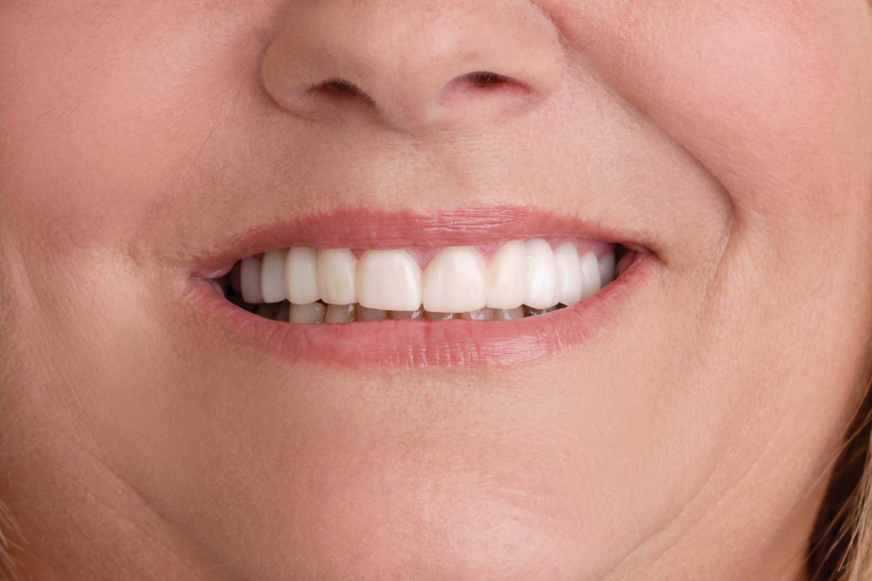 Life Smiles Dental Care | Chula Vista