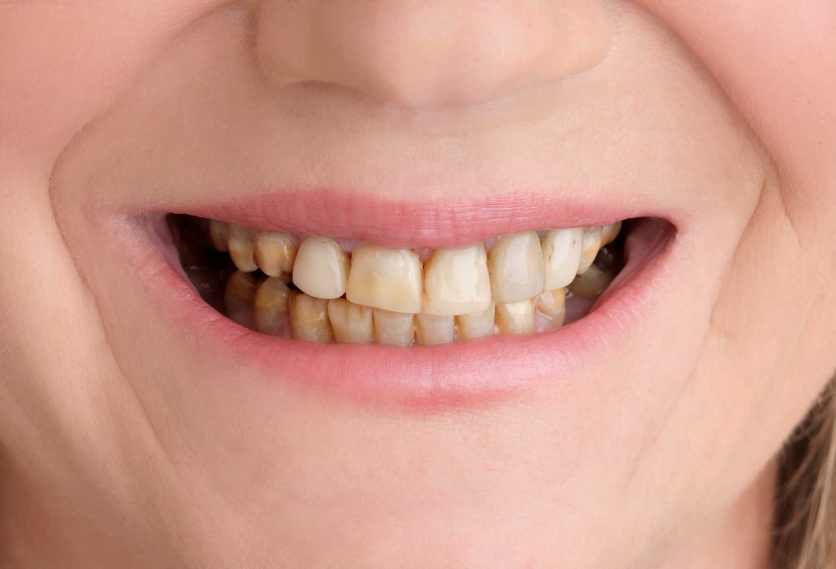Life Smiles Dental Care | Chula Vista