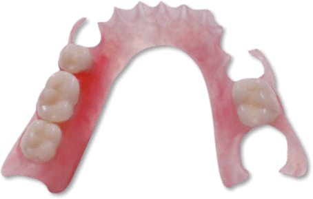 Partial Dentures